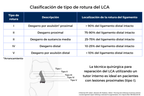 Cirugía conservadora para la rotura de ligamento cruzado anterior ...